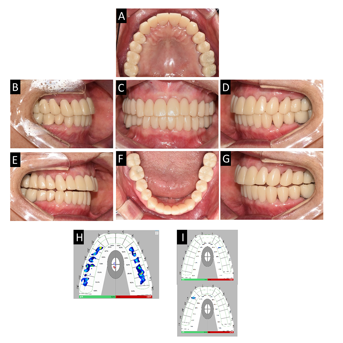 Complete Mouth Rehabilitation Through Integration of Multi-source ...